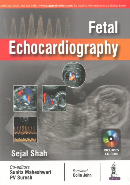 Fetal Echocardiography: 洋書／南江堂